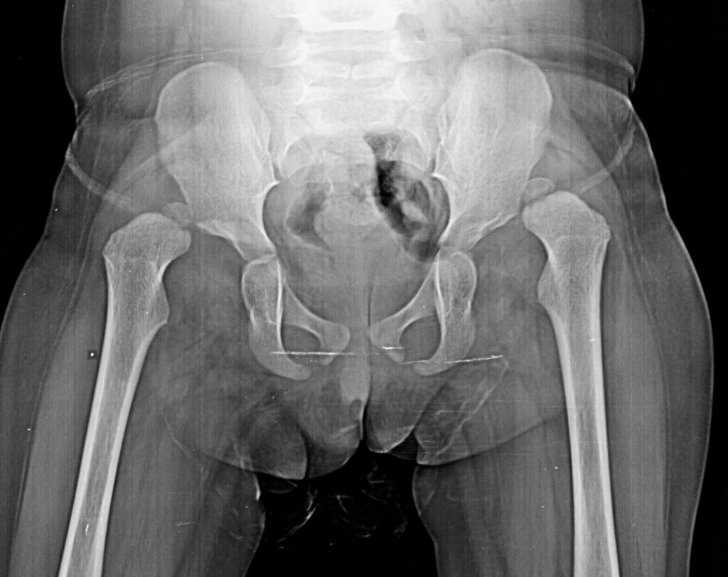 PediatricOrthopedic Surgeon in Allahabad, India | Child Specialist ...