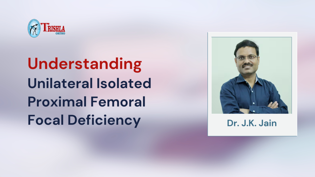 Understanding Unilateral Isolated Proximal Femoral Focal Deficiency ...