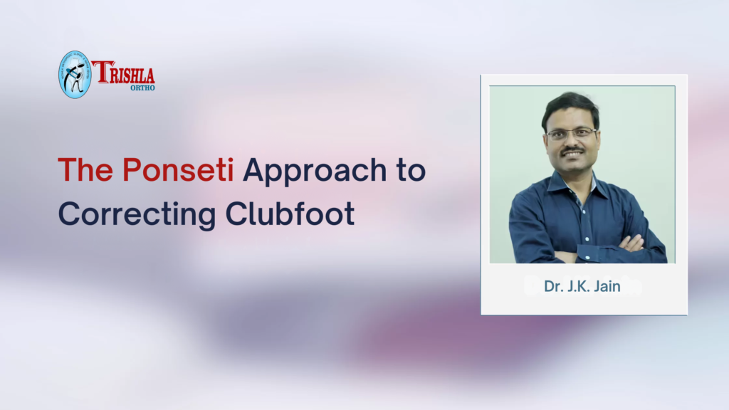 The Ponseti Approach to Correcting Clubfoot - Trishlaortho