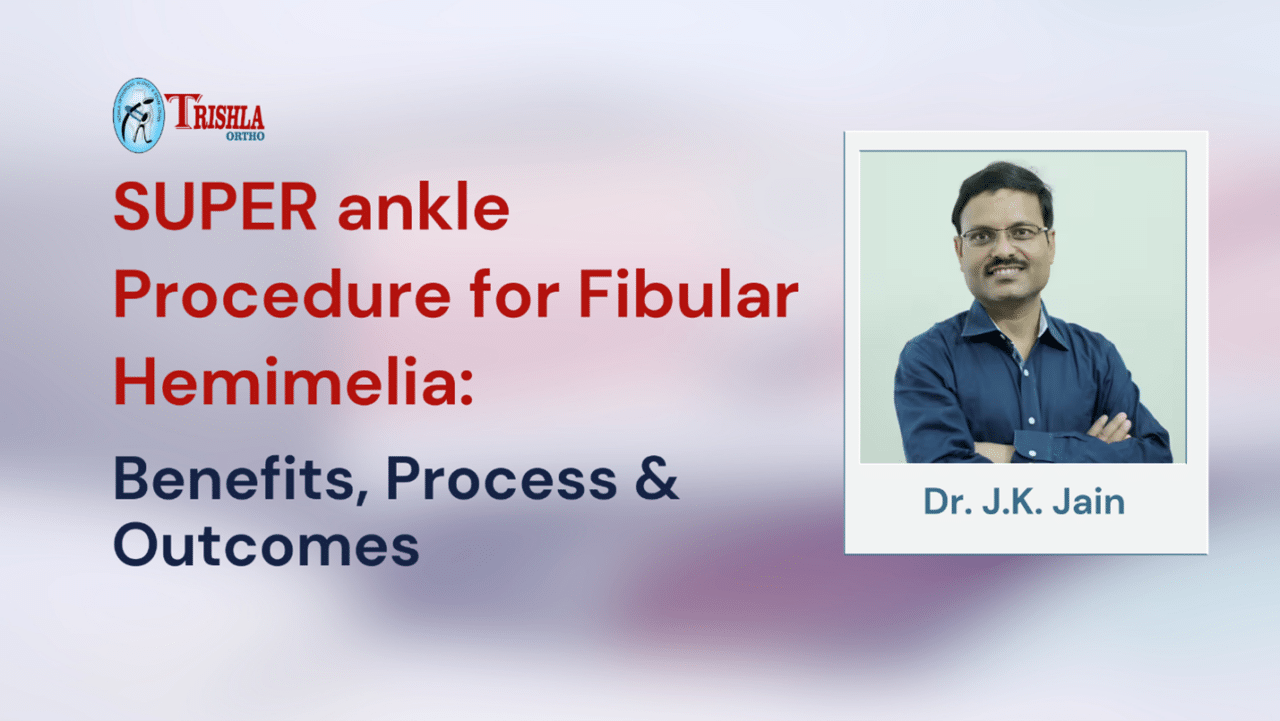 SUPER ankle Procedure for Fibular Hemimelia: Benefits, Process ...