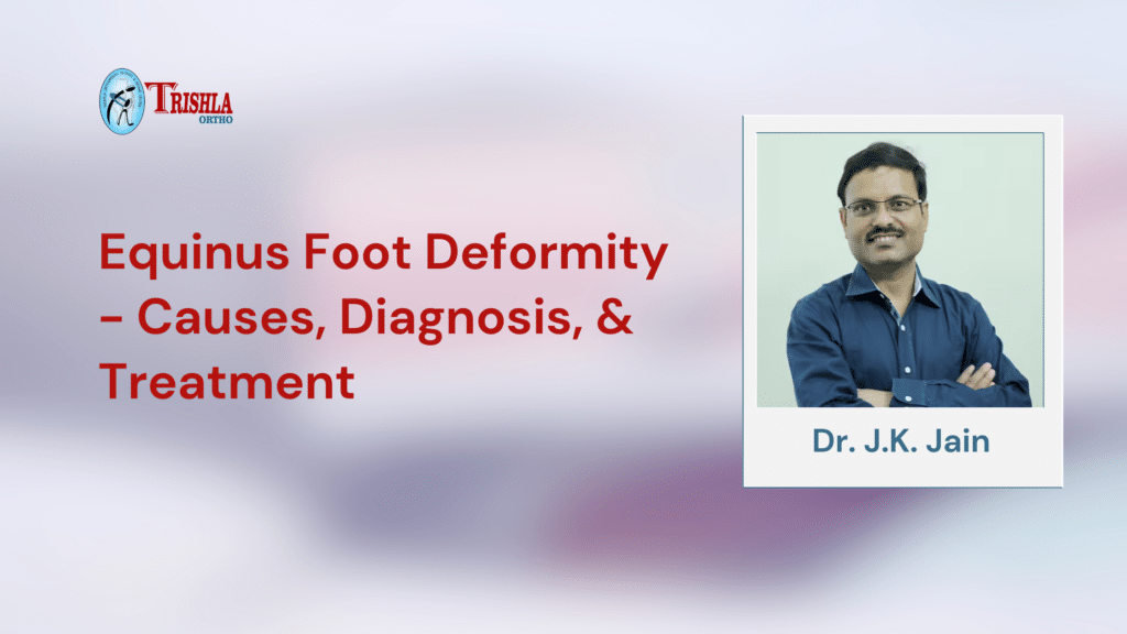 Equinus Foot Deformity: Causes, Diagnosis & Treatment | Trishla Ortho