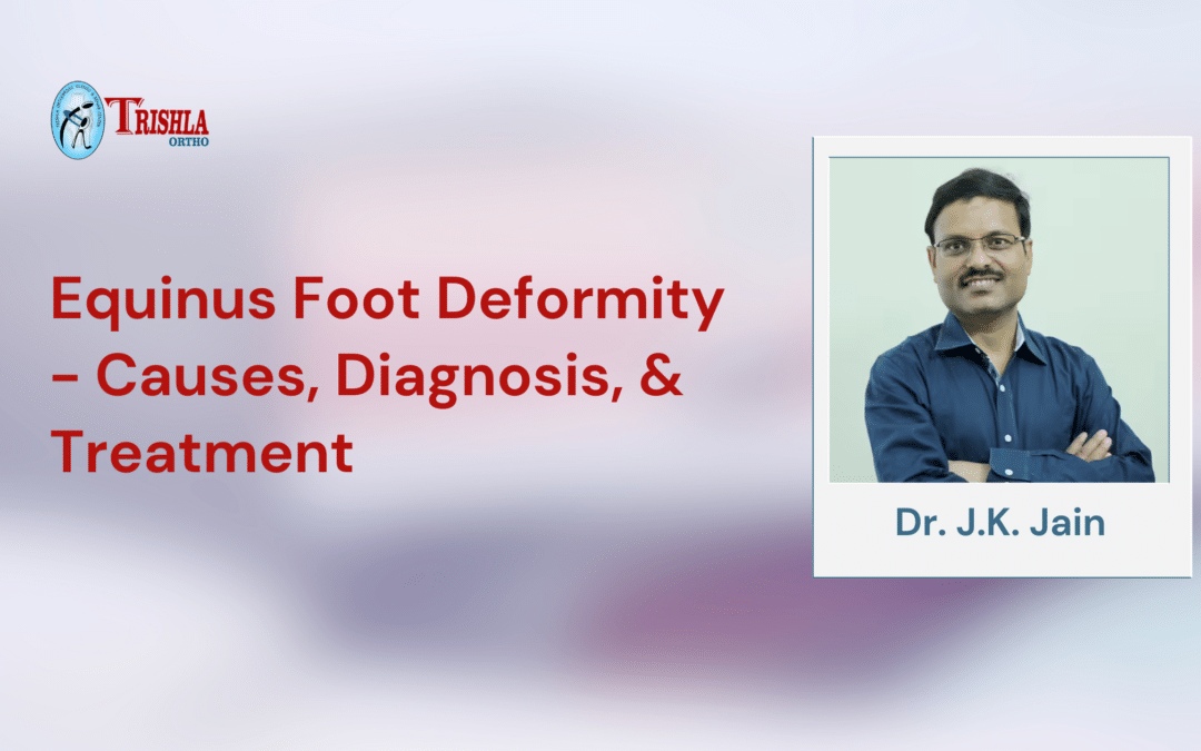 Radiology in Diagnosing Perthes Disease - Trishlaortho